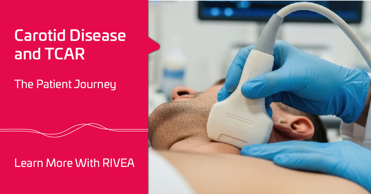 Carotid Disease & TCAR: Minimally Invasive Stroke Care