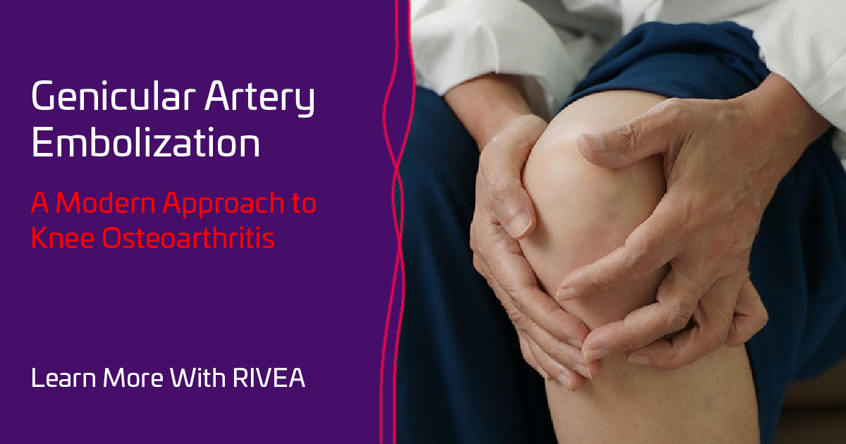 Genicular Artery Embolization: Relief for Chronic Knee Pain