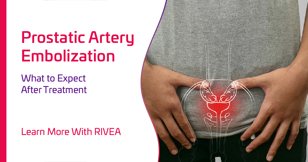 Prostatic Artery Embolization Recovery | Rivea Vascular