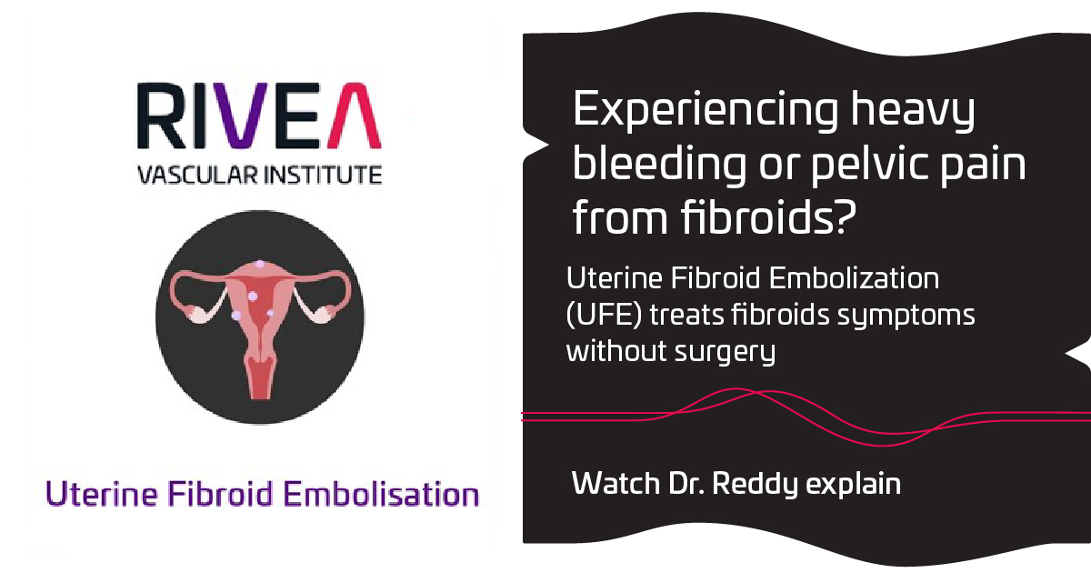 Uterine Fibroid Embolization in Hyderabad | RIVEA Vascular