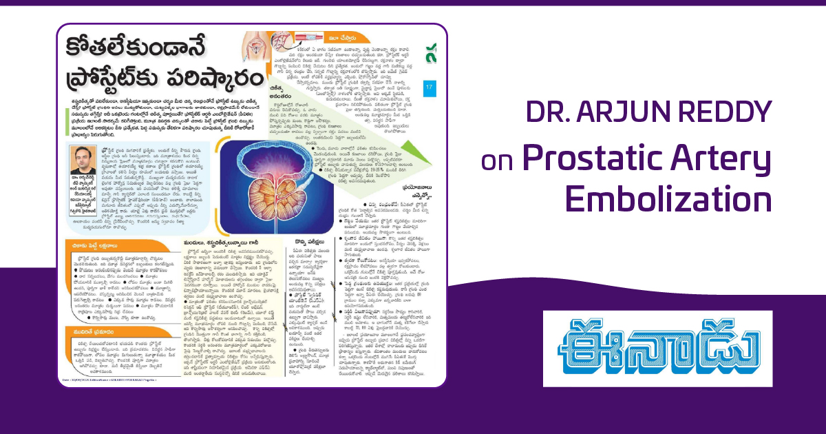 Non‑Surgical Prostate Treatment in Hyderabad | RIVEA Vascular Institute