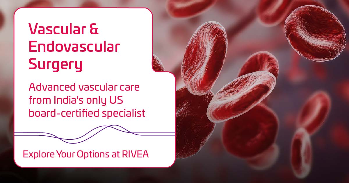 RIVEA Hyderabad – Expert Vascular & Endovascular Surgery